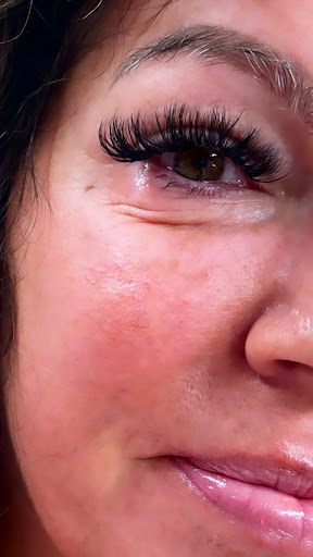 WellAve Dermatology- Salisbury, MD - Specialist in Beauty Services at ...